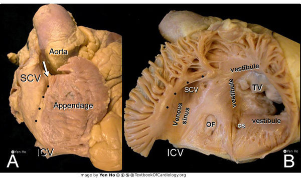 Anatomy of the Heart - Textbook of Cardiology