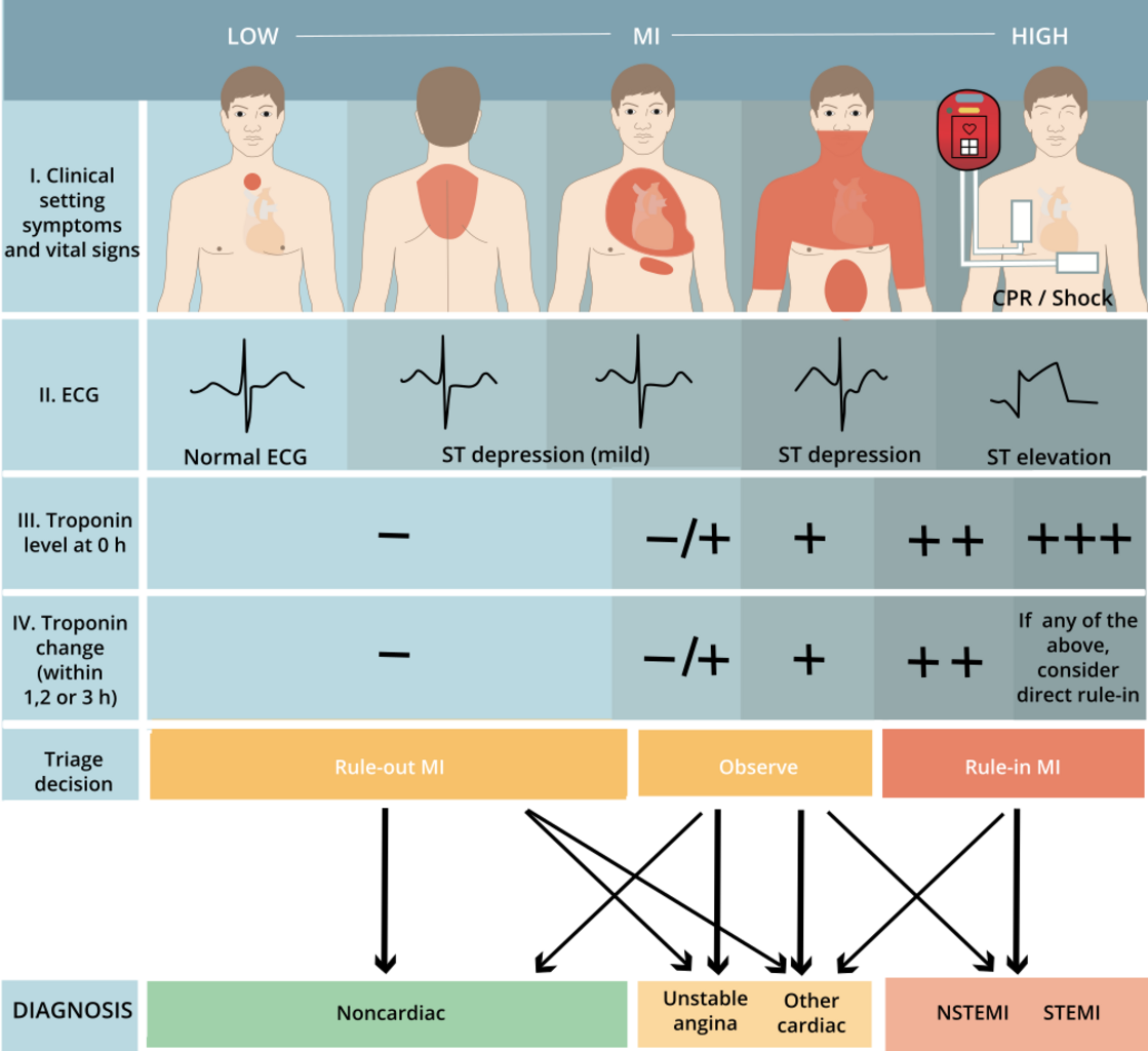 File:Chest pain to NSTEMI STEMI v2.svg - Textbook of Cardiology