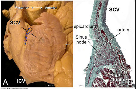 Anatomy of the Heart - Textbook of Cardiology