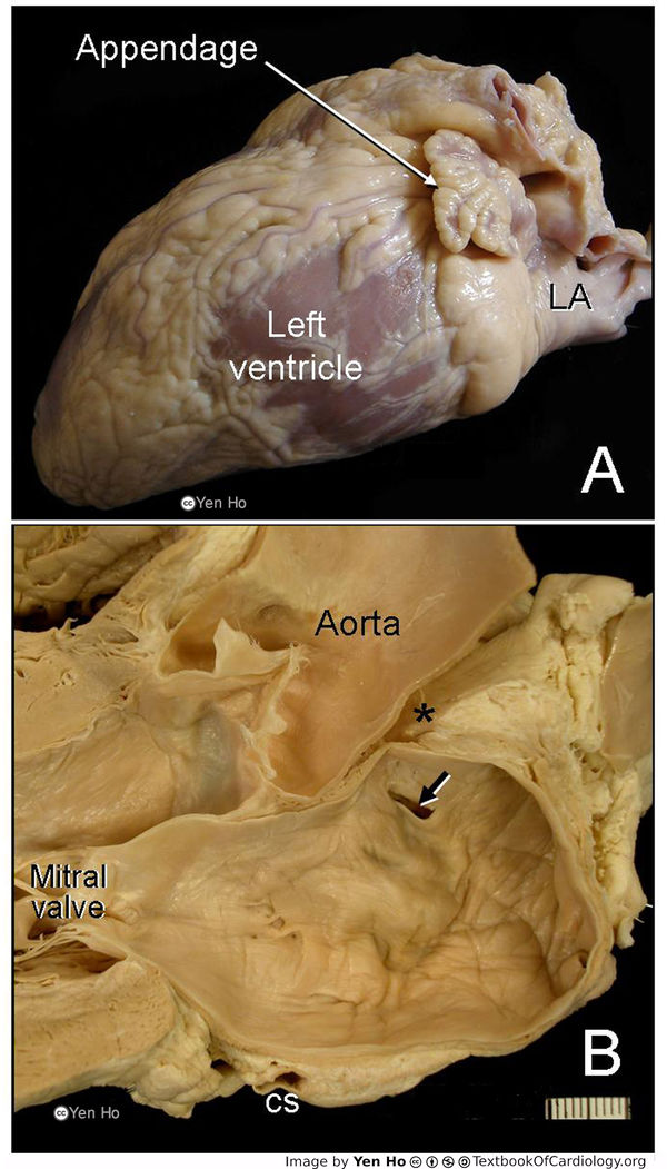 Anatomy of the Heart - Textbook of Cardiology